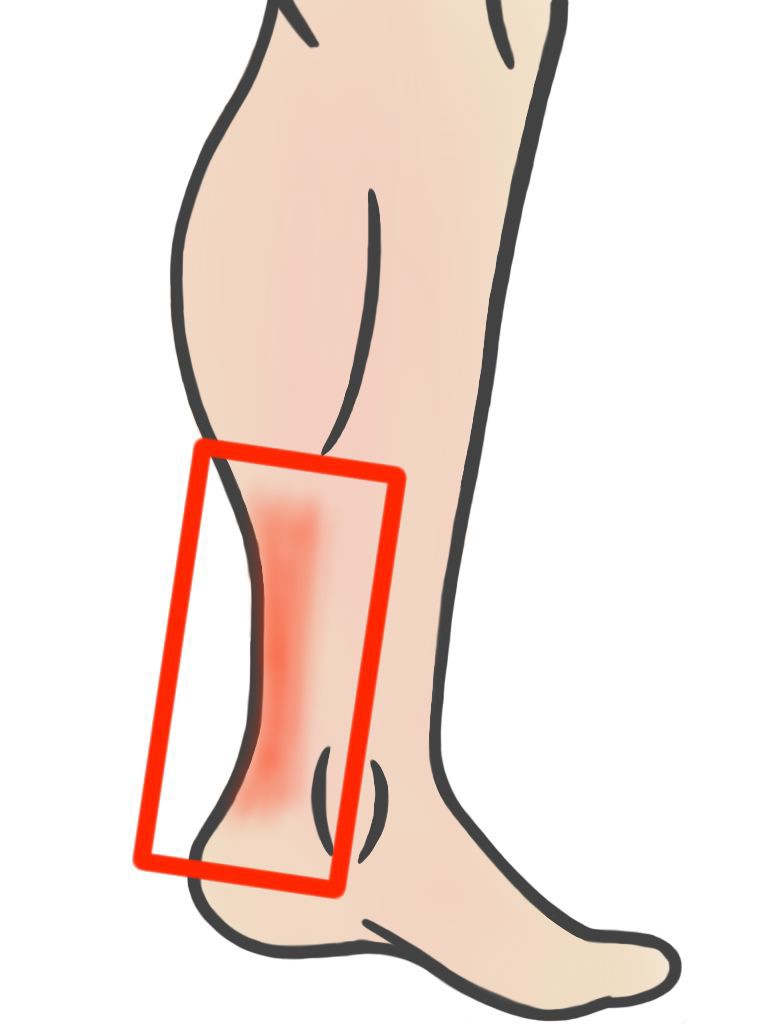 Soft Tissue Therapy - Tendon Touch Test - Achilles Tendon - Prehab ...